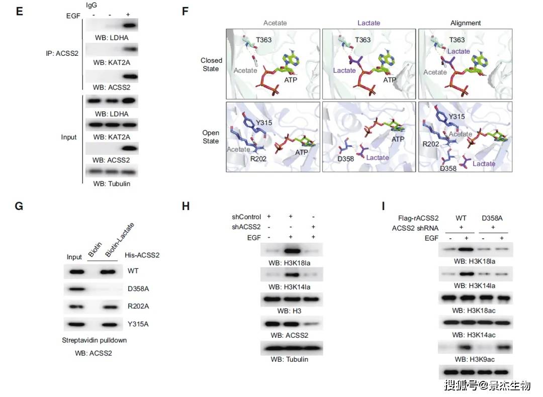 Cell Metab | 浙大吕志民揭示首个乳酰辅酶A合成酶ACSS2_乳酸_研究_位点