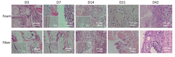 PGA Biofelt植入级无纺布聚乙醇酸 (PGA) 是一种可快速生物降解的聚合物，可用于各种植入物_支架_研究_荧光