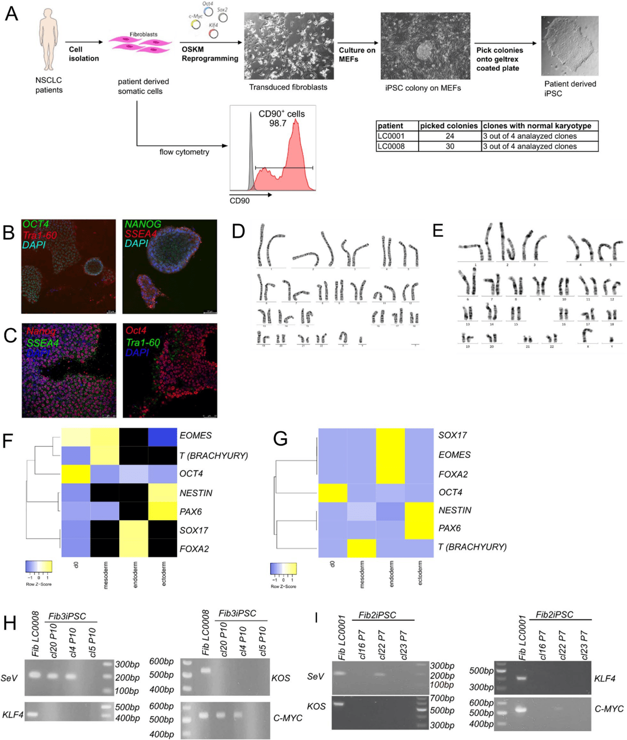 精准打击！利用iPSC衍生肺和肺癌类器官模型评估顺铂药物递送系统_细胞_研究_克隆
