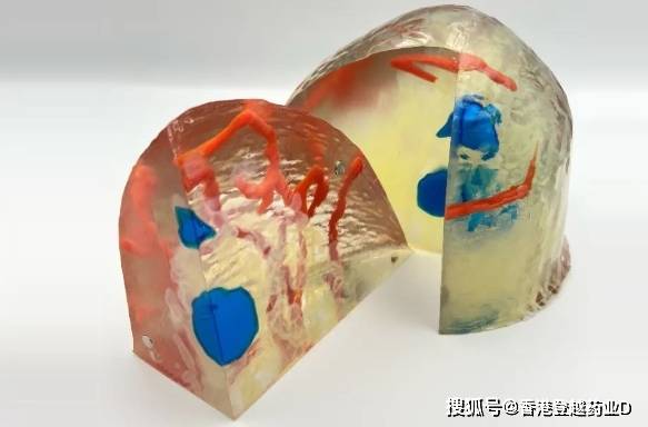 TumorSight Viz 已获得第二次 FDA 510(k) 批准_患者_治疗_SimBioSys