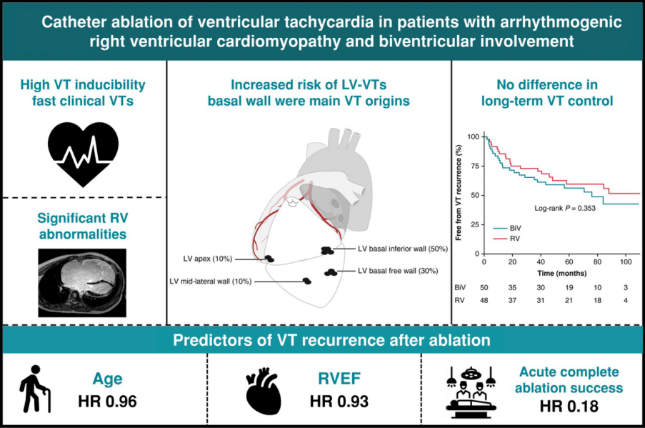 ARVC双室受累后室速严重且复杂，射频消融仍有效！阜外姚焰团队研究_患者_左室_右室