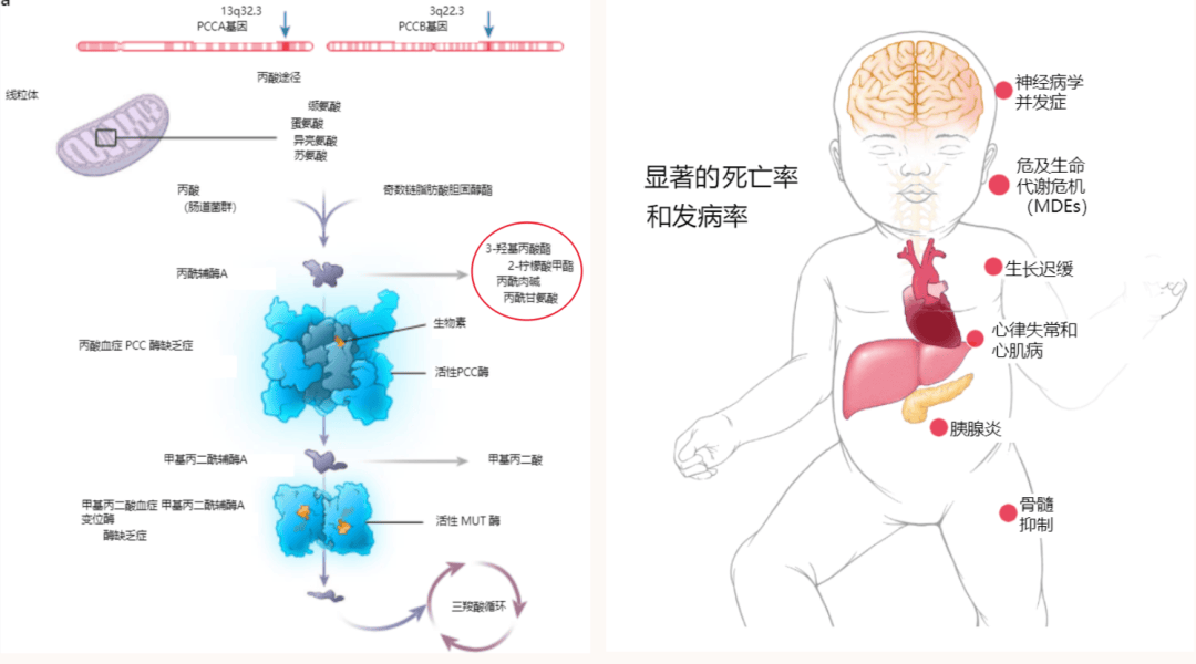 Moderna丙酸血症酶替代药物mRNA-3927首次临床数据_代谢_亚基_肝脏