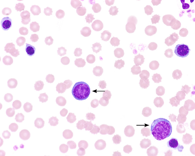 红细胞形态评估：总结有核红细胞的5种分类与临床意义_细胞核_细胞质_反应