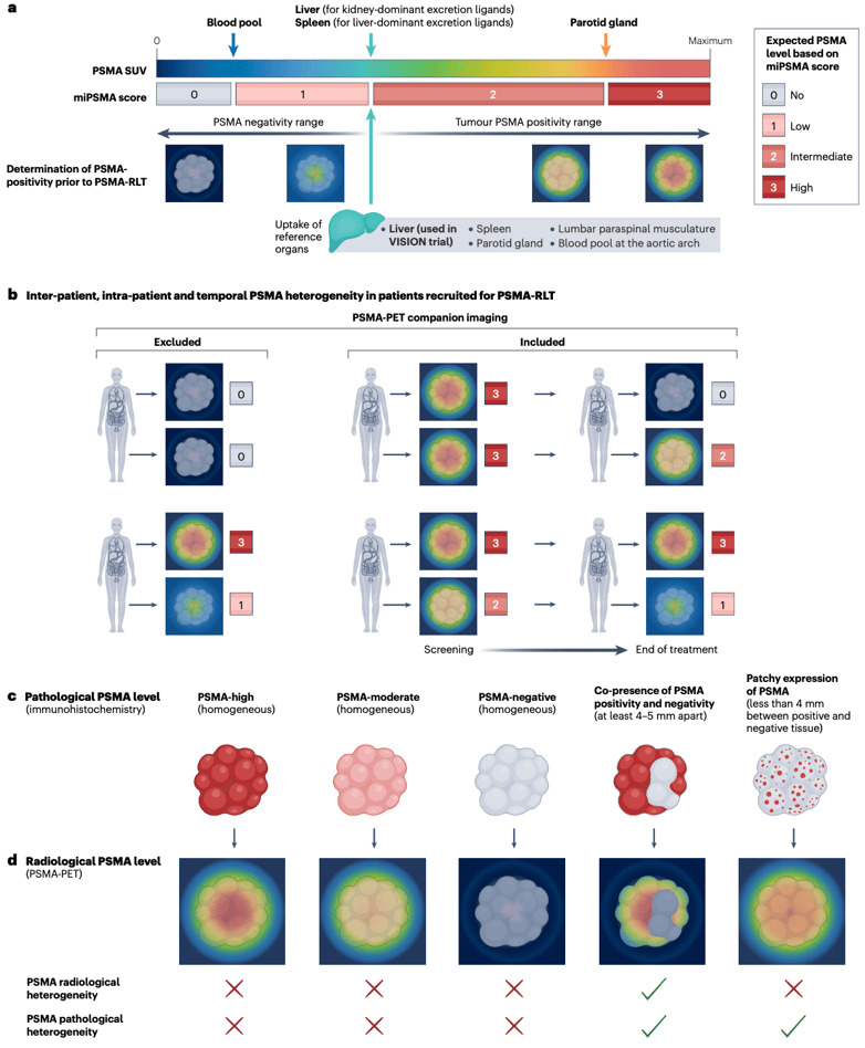 Nat Rev Cancer丨前列腺癌的PSMA表达、调控和异质性分析_成像_治疗_患者