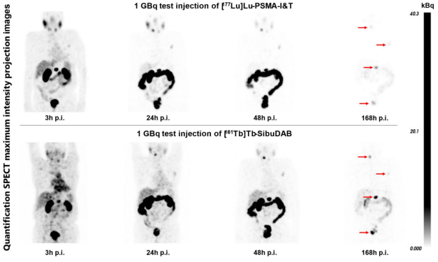 【深度】关于161Tb药物的PROGNOSTICS Ⅰa期临床试验研究的部分成果_Tb-SibuDAB_治疗_肿瘤